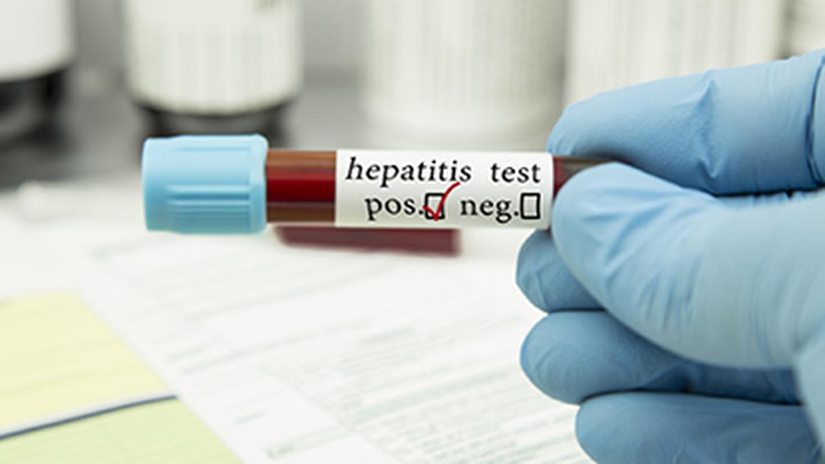 Rise in Hepatitis-A cases sparks concern over waterborne diseases ... Rise in Hepatitis-A cases sparks concern over waterborne diseases ...